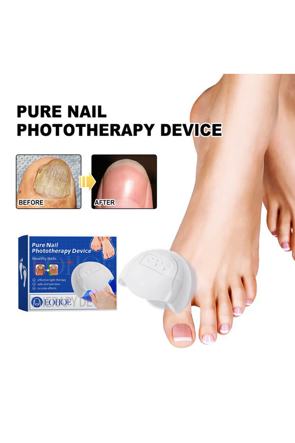 Choice Nail Fungus Laser Device Fungal Nail Treatment Repair ...