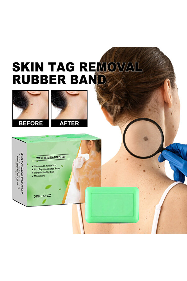 Choice Smooth Skin Wart Elimination Soap, Natural Soap, Instant Wart ...