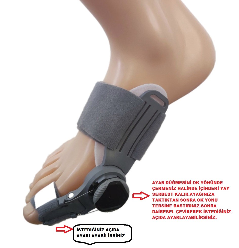 başarı ortopedi Ayak Baş Parmak Parmağı Kemik Kemiği Çıkıntısı İçin ...