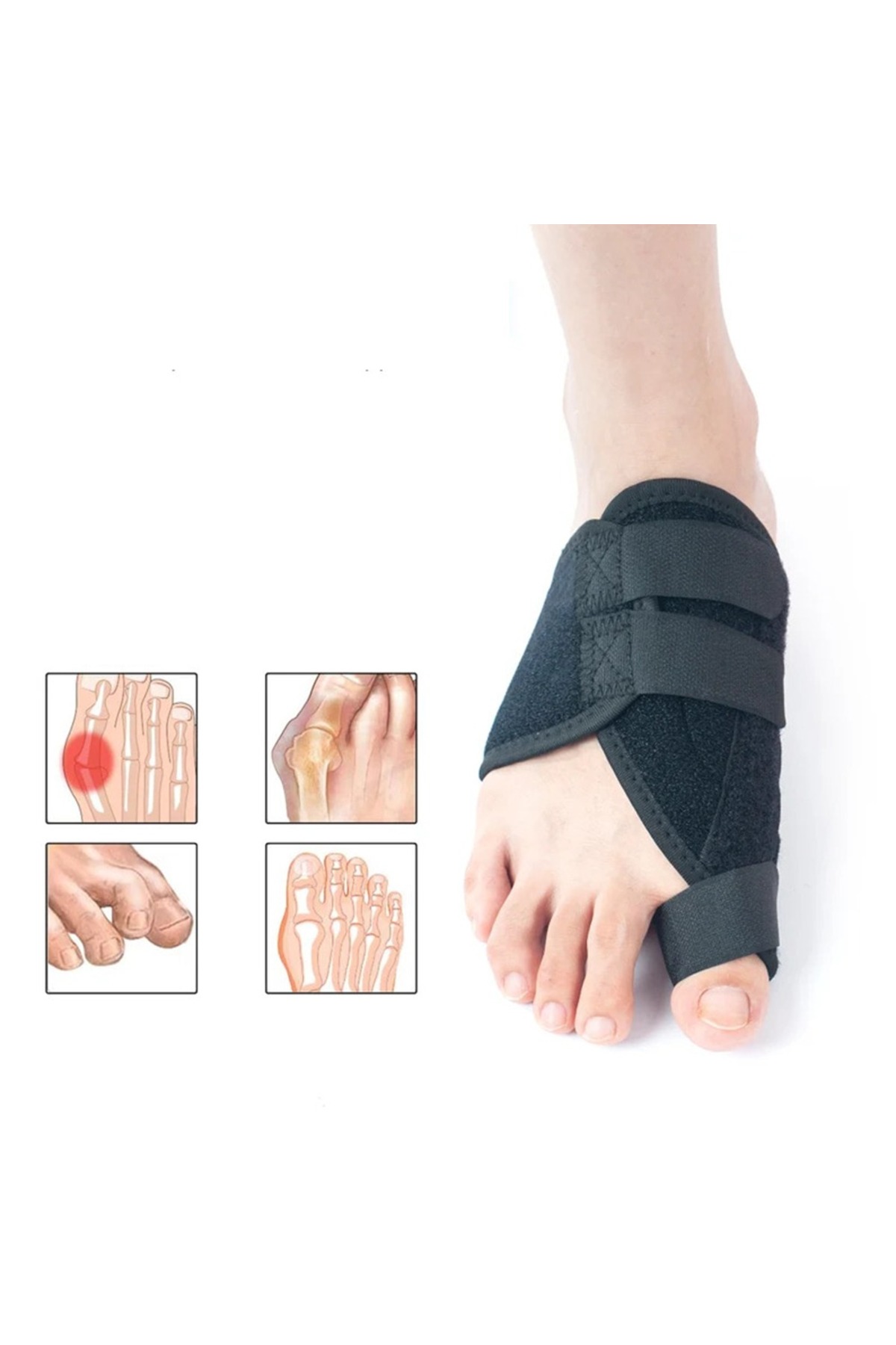Arnee Çift Halluks Valgus Gece Ateli Başparmak Düzeltici Ayak Kemik ...