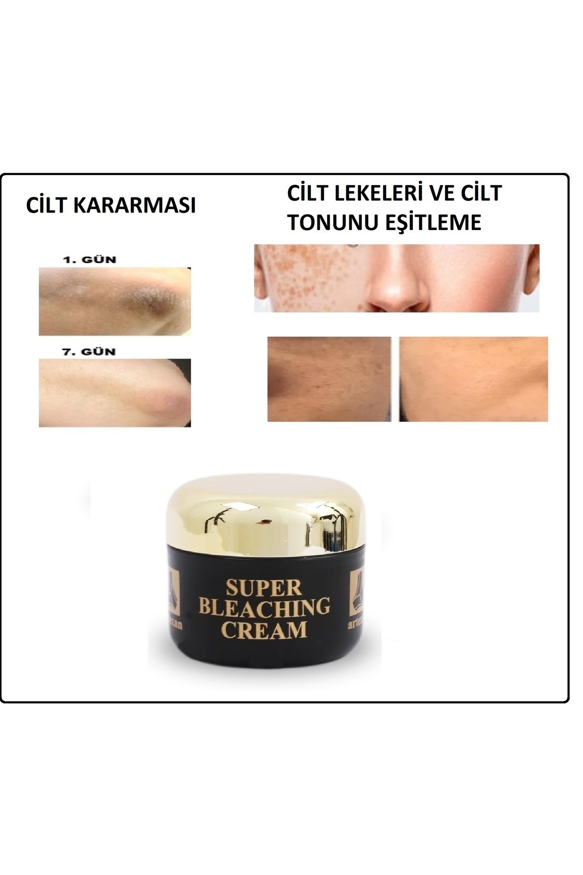 artexan Almanya'dan Ithal Cilt Leke Kremi, Cilt Tonu Düzenleyici/super ...