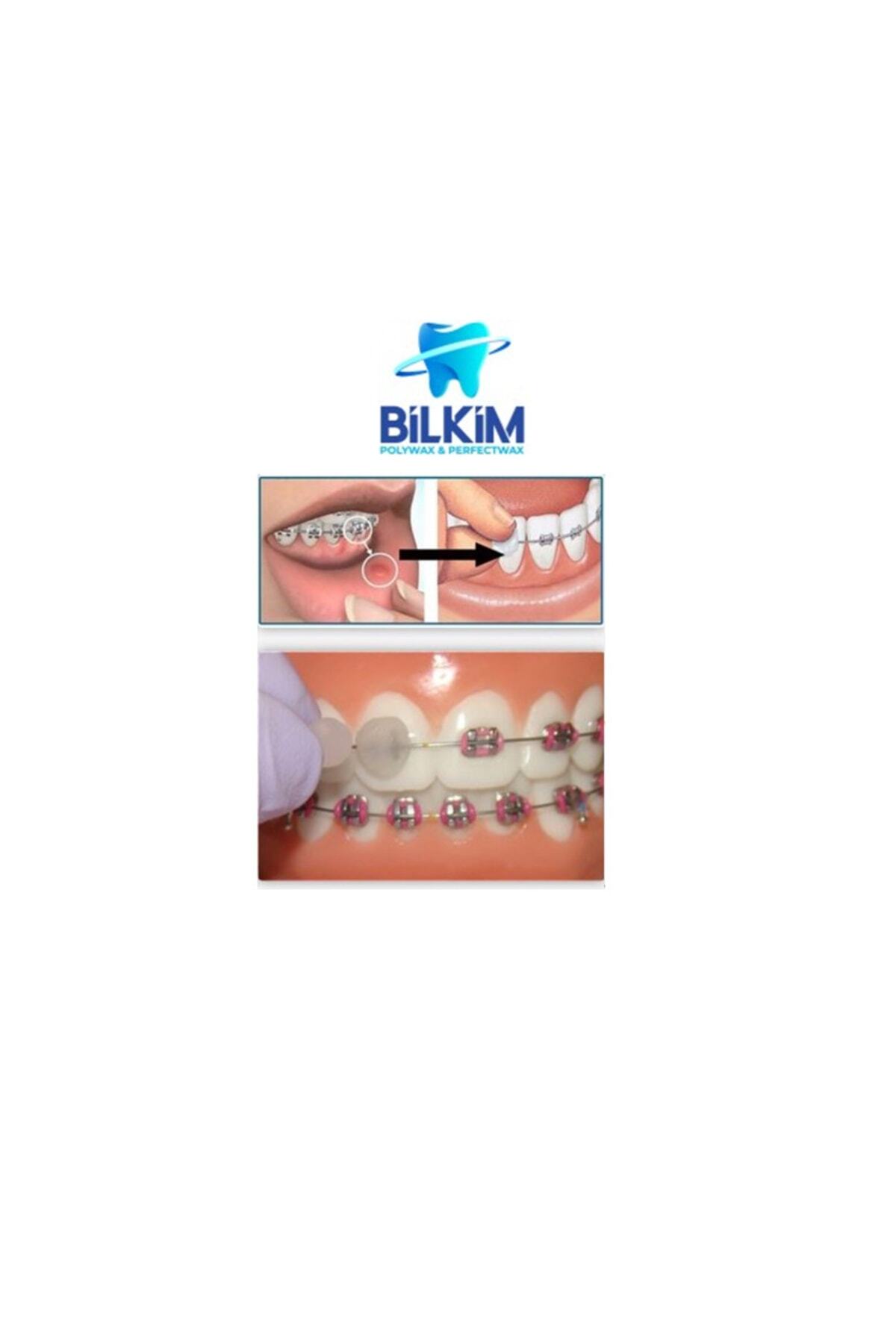 POLYWAX 5 Adet Limon Aromalı Ortodonti Mumu-Diş Teli Mumu-Braket Mumu ...