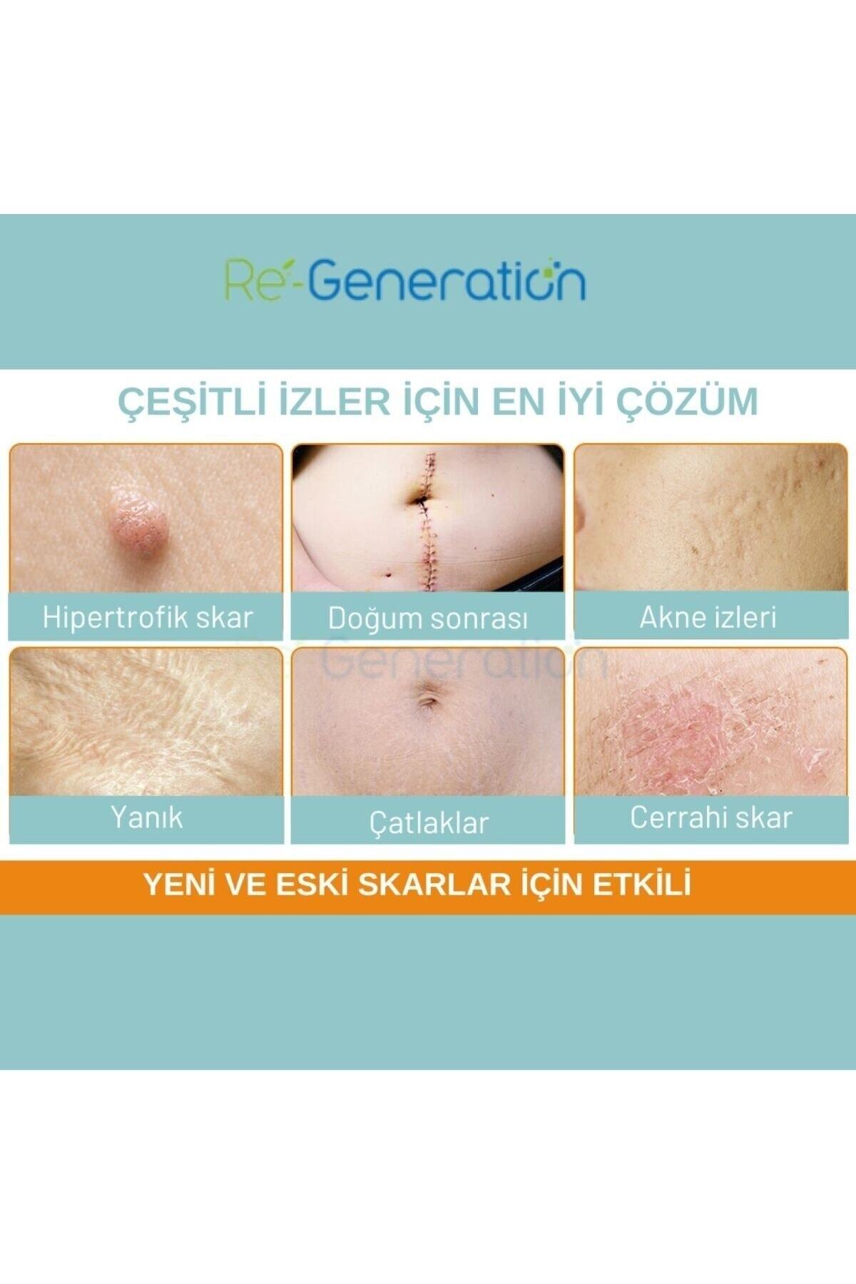 RE-GENERATION Silikon Sheet - Yara Bakımı, Yanık Izi, Ameliyat Izi ...