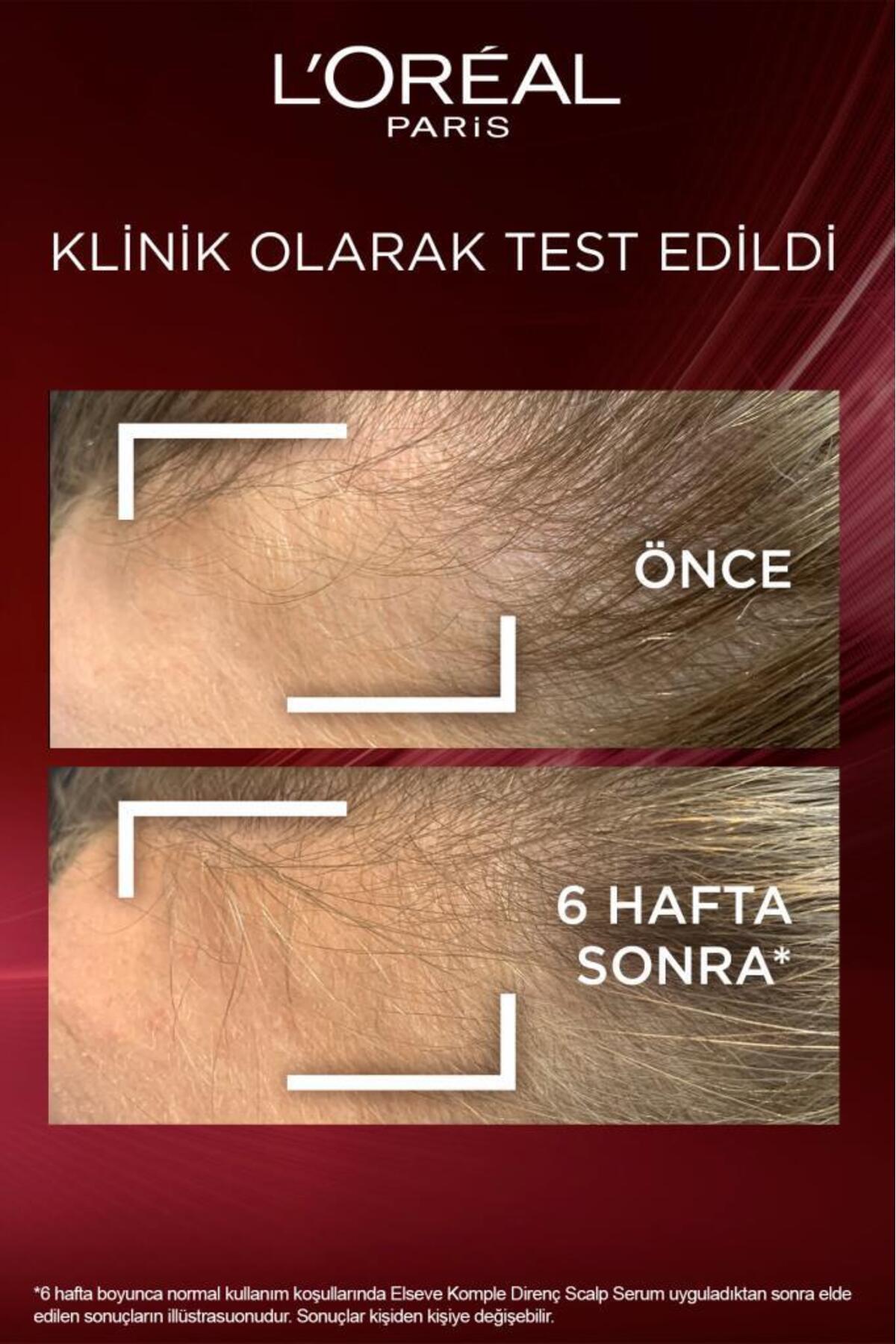 Elseve Komple Direnç %1.5 Aminexil [Kafein + Arginine] Dökülme Karştı ...
