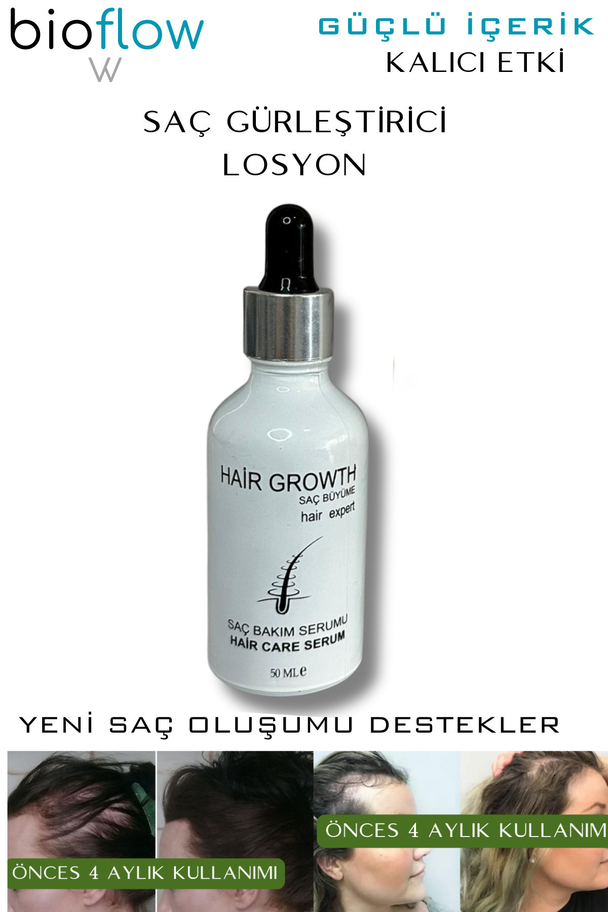 BioFlow Saç Çıkarıcı - Saç Gürleştirici - Saç Bakım Losyonu - 5 Adet ...