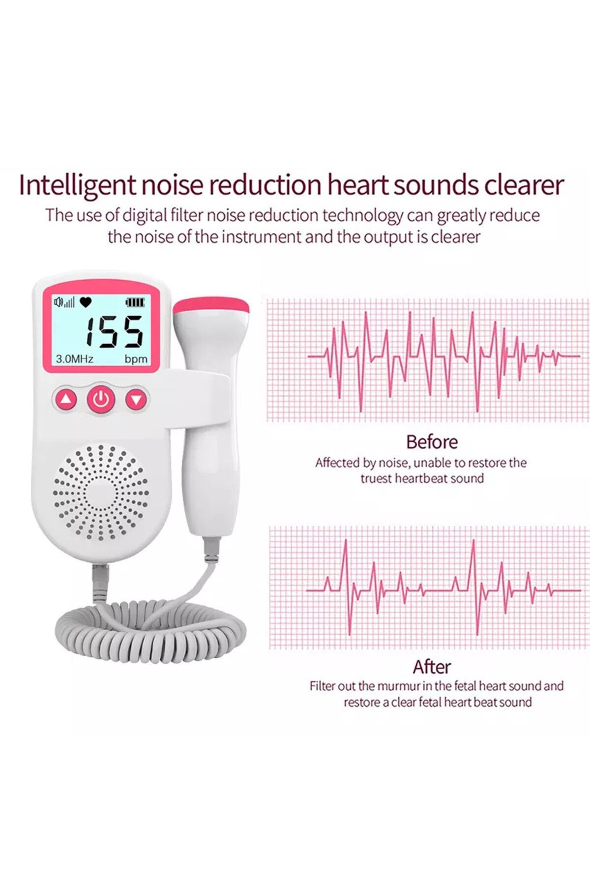 teknotrust Fetal Doppler Jsl- T501 3 Mhz Hamile / Bebek Kalp Atışı ...