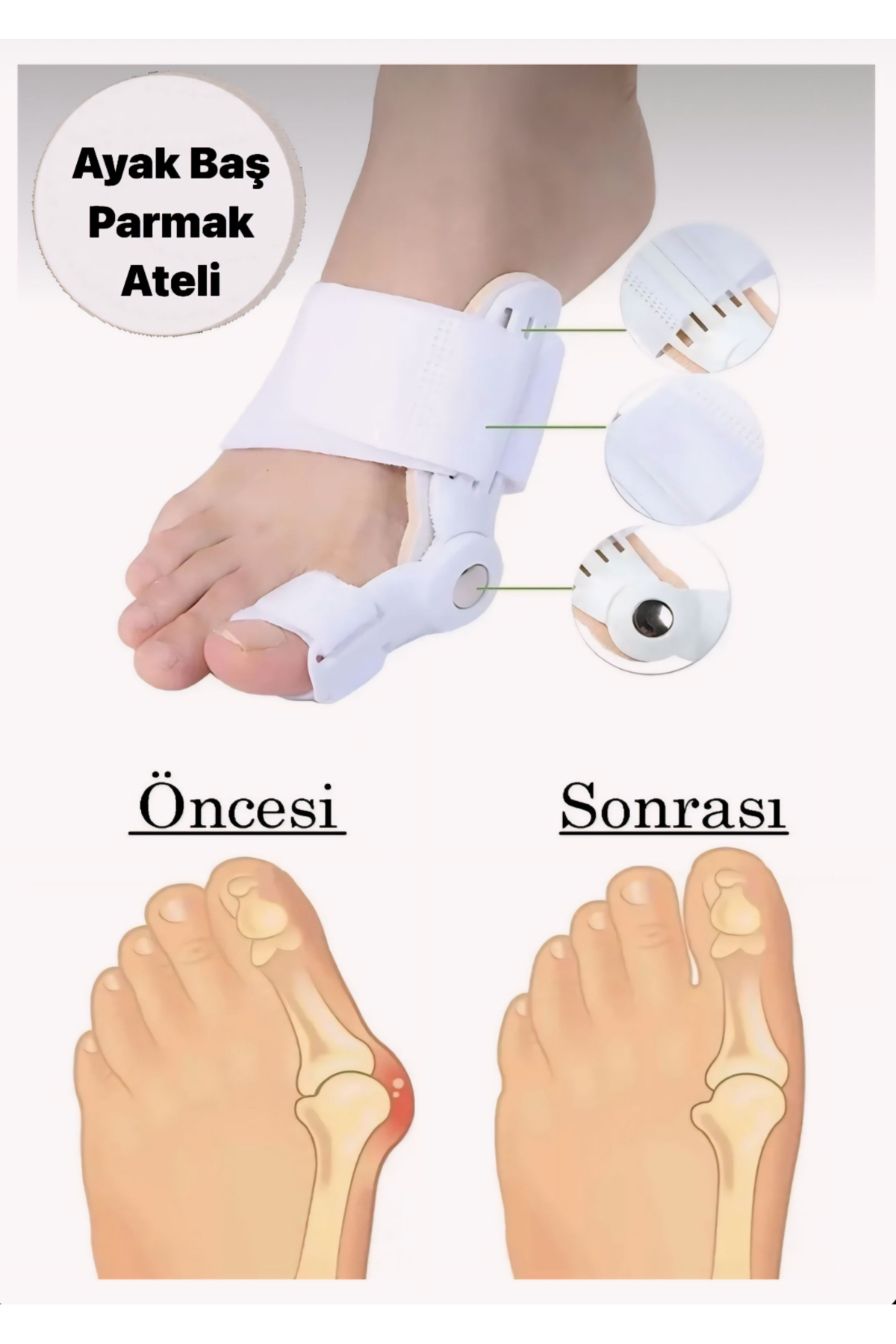 Mi-ÇA HOME Ayak Baş Parmak Düzeltici Aparat Atel / Ayak Kemik Eğriliği ...