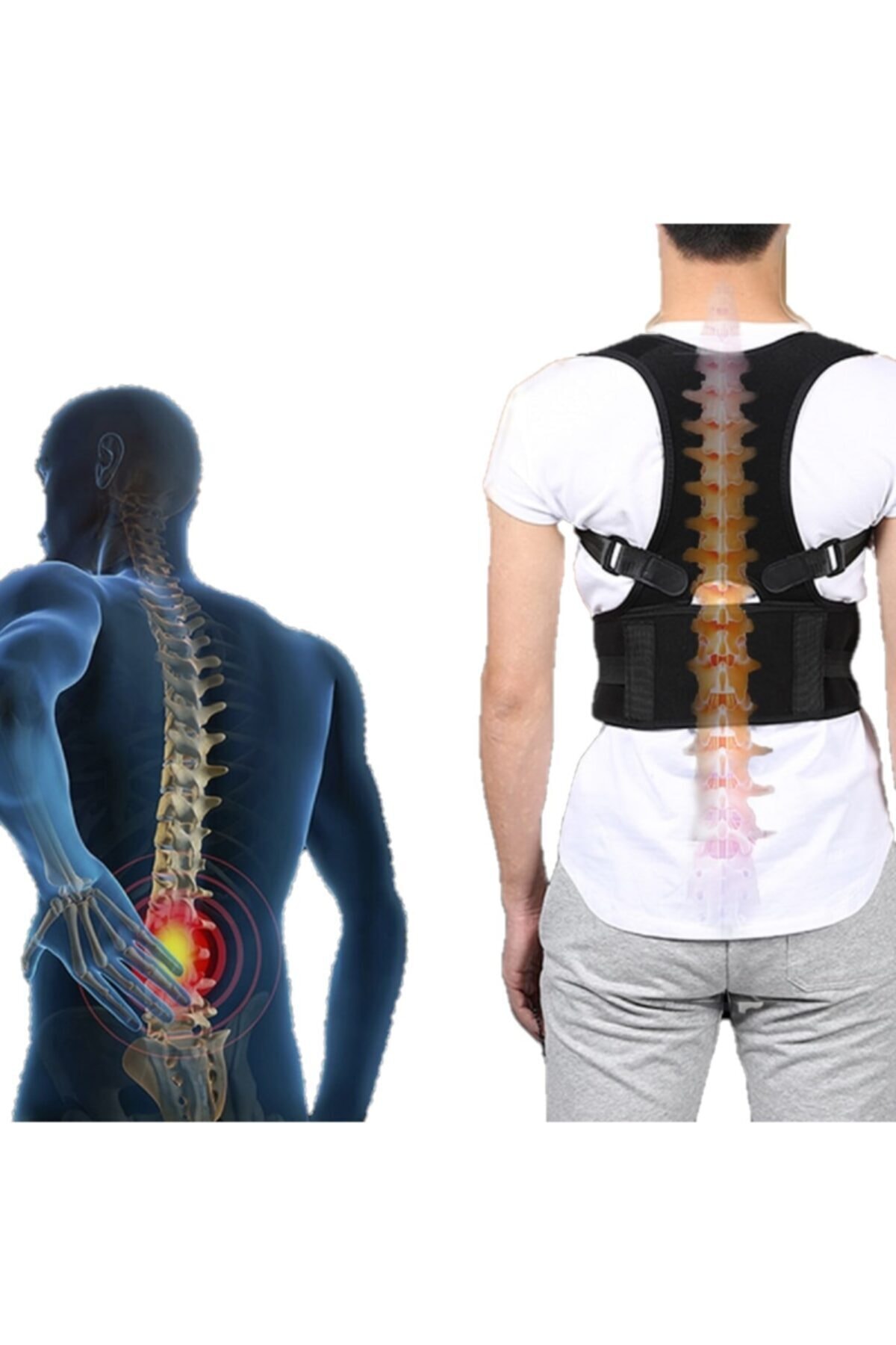 Ankaflex Medical Kyphosis Corset Scoliosis Corset Magnetic Orthopedic ...