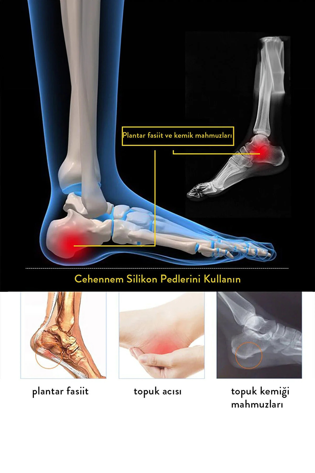 Factorial Ortapedik Ayakkabı Topuğu Jel 1 Çift Topukluk Gizli Topuk Boy ...
