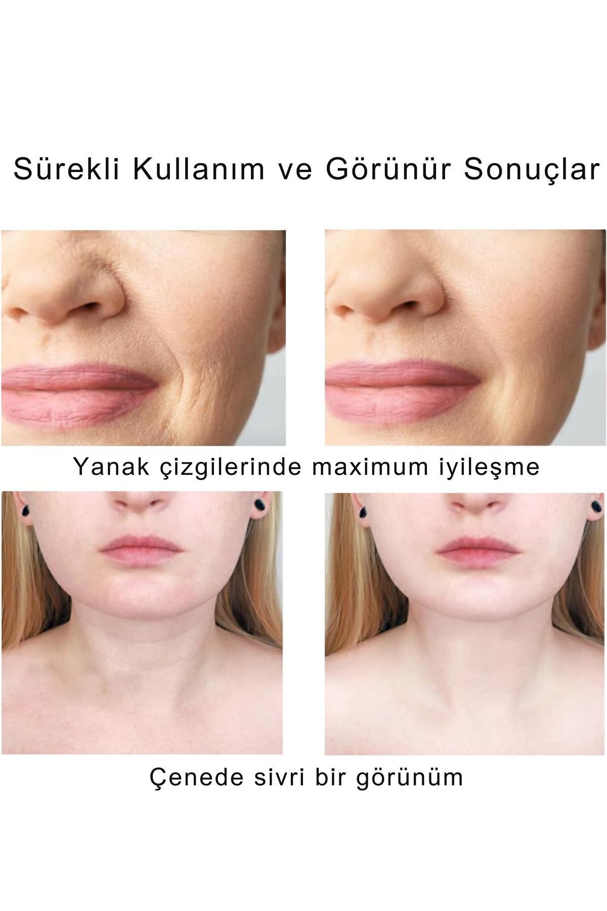 Morlay Moon™ 7 Renk Foton Yüz Ve Boyun Ems Güzellik Cihazı 42° Sarkma ...