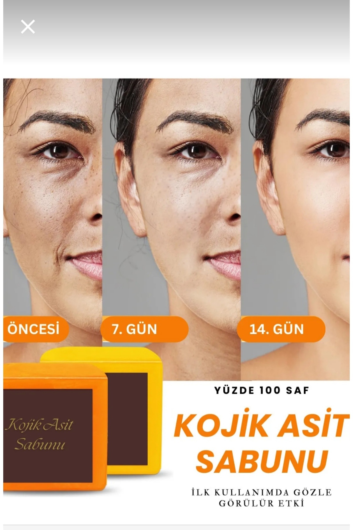 MAGO SHOP Mago Kojic Asit Sabunu, Zerdeçal Ve Kojik Asit Etkisi Ile ...