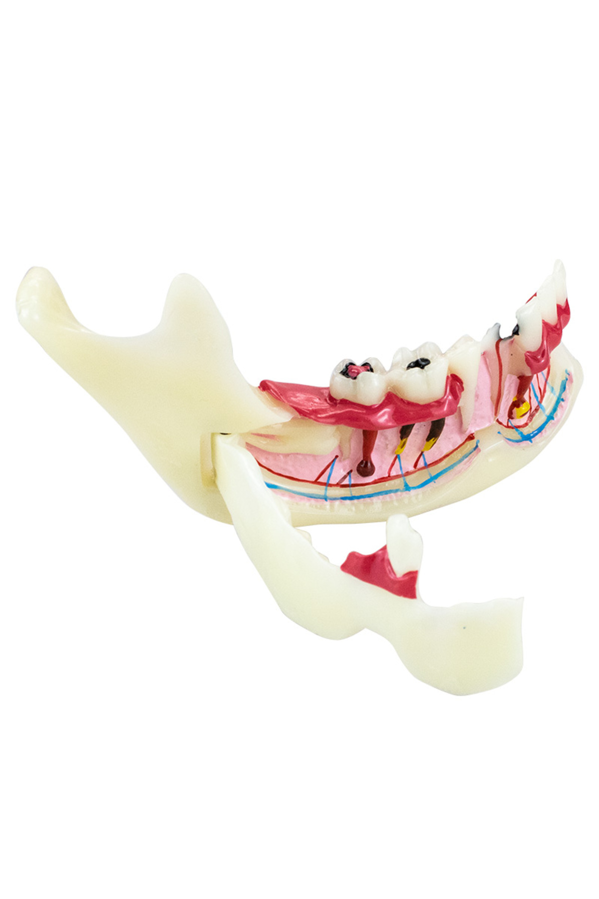 Choice 1Pcs Teeth Model Dental Endodontic Treatment Model Anatomy of ...
