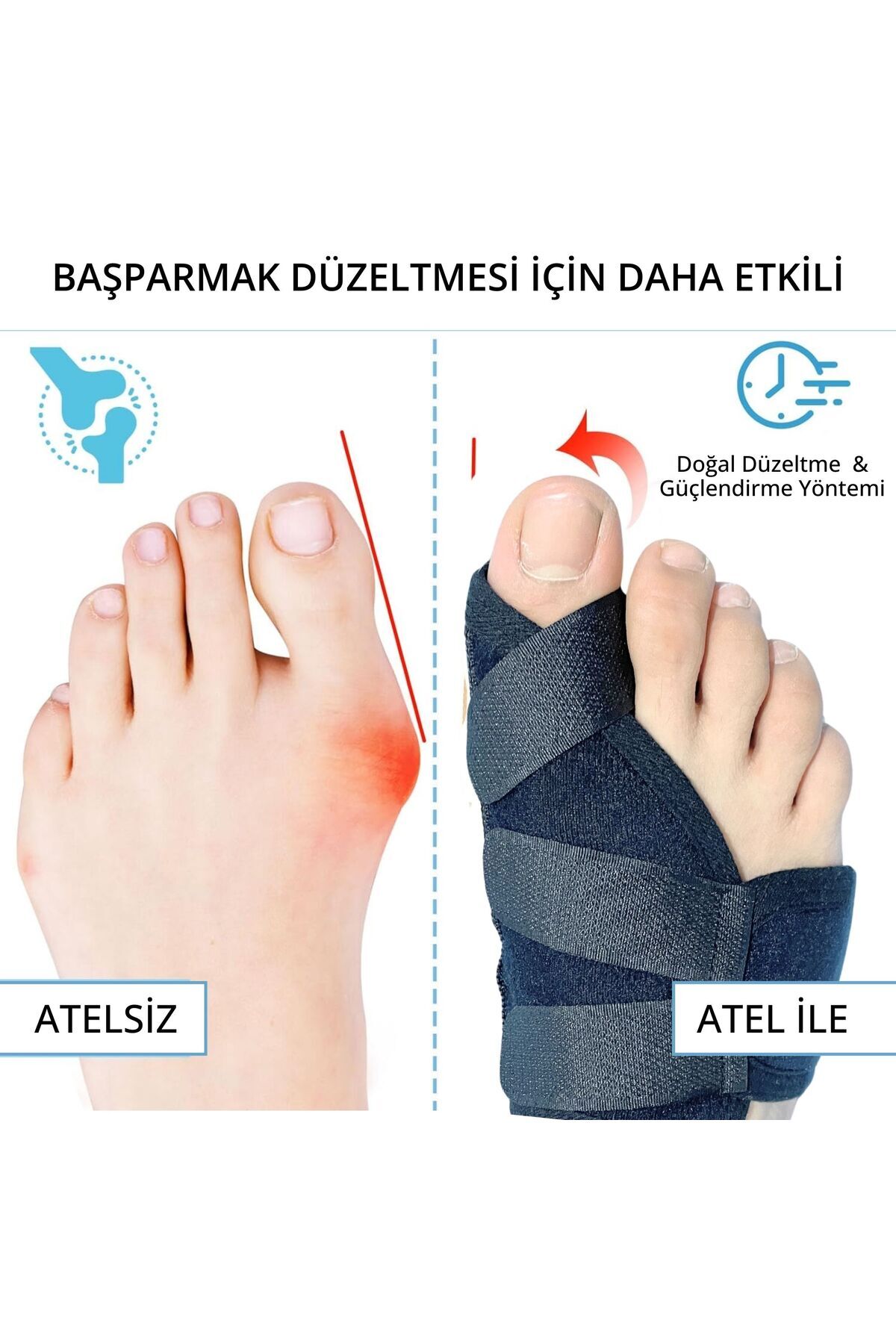 KARACİF 1 Çift (SağSol) Medikal Halluks Valgus Gece Ateli Balenli Ayak ...