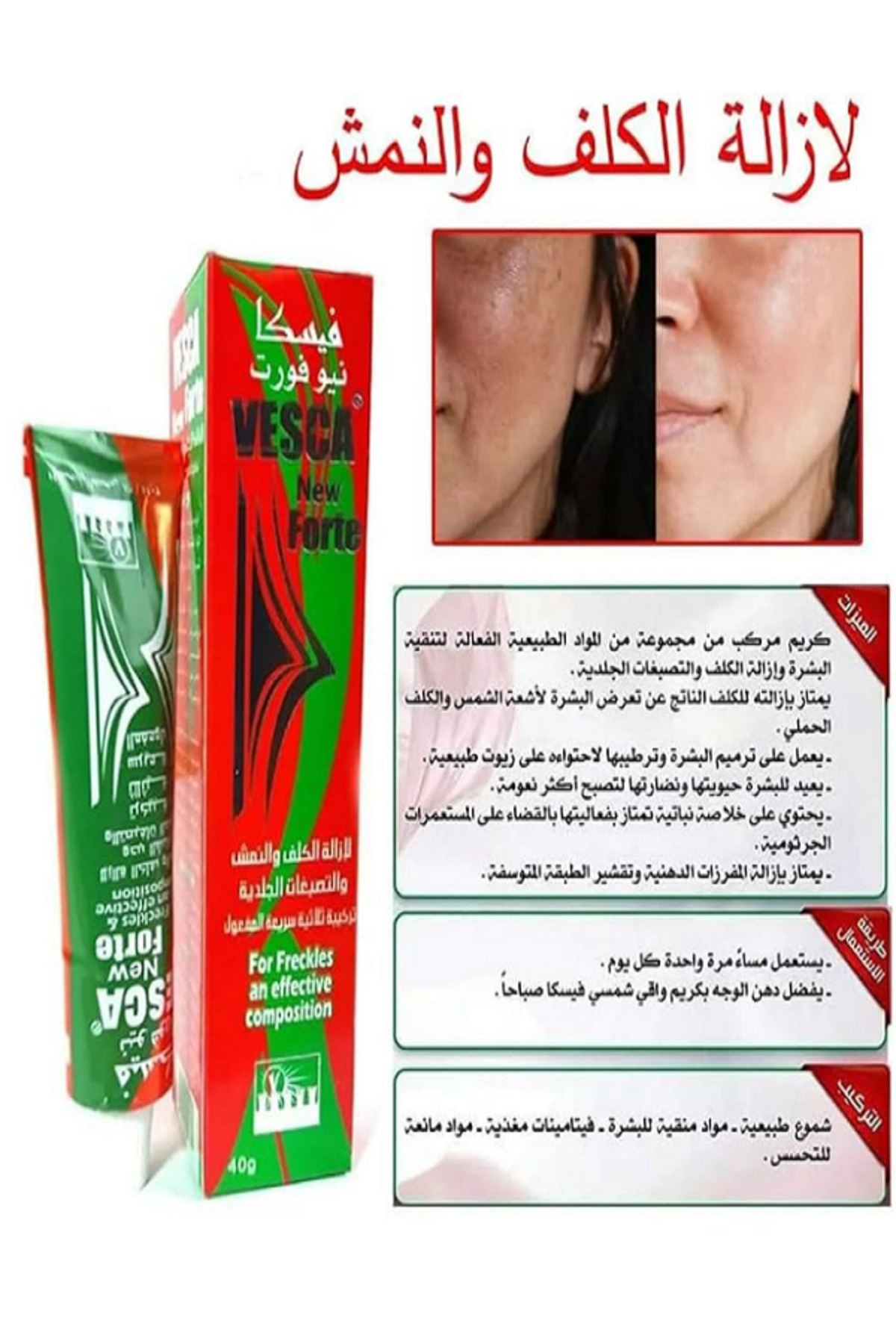 Vesca New Forte krem Anti Age Akne Ve Cilt Kusurları Ve Ölü Hücre ...