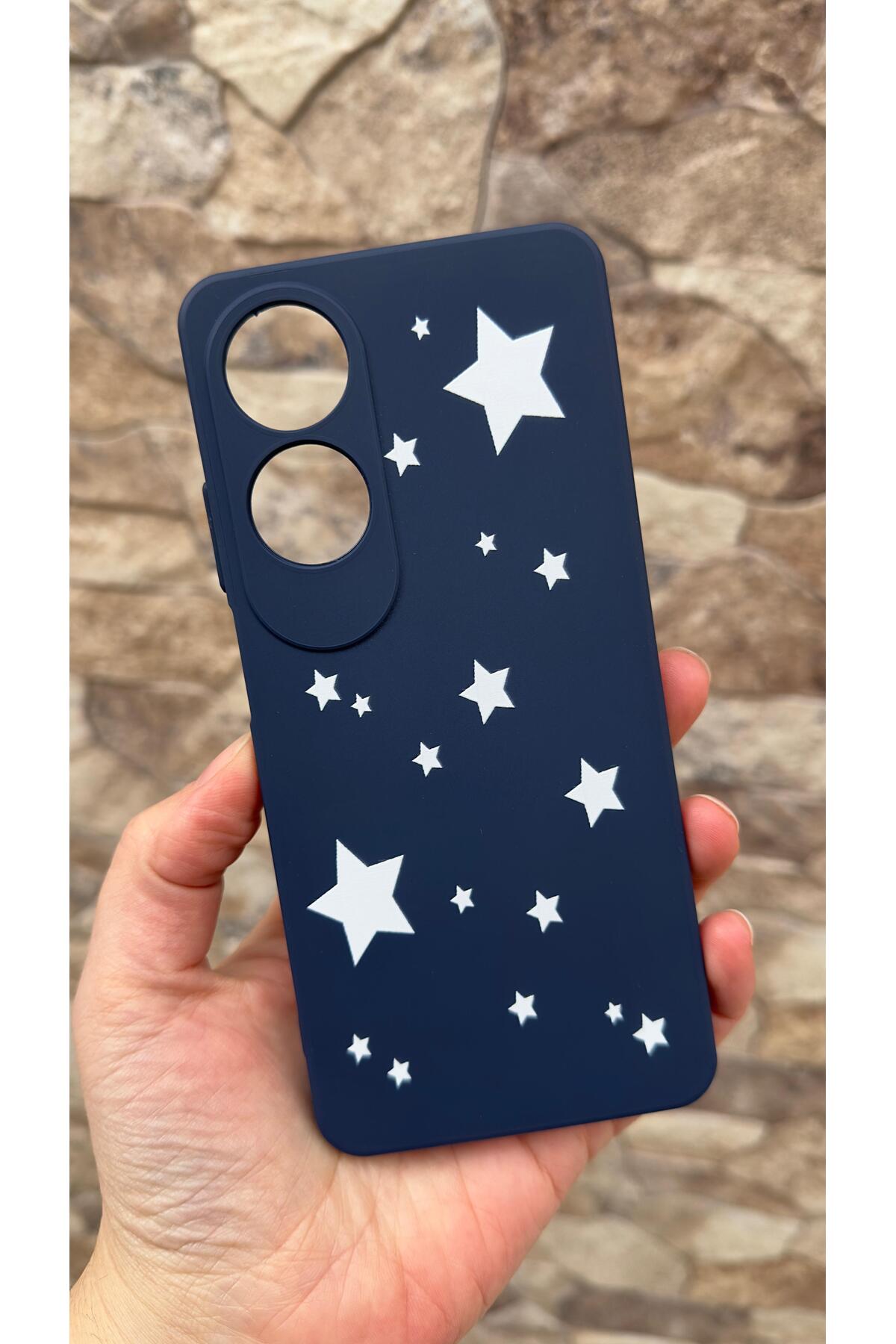 Vip Case Oppo A60 Uyumlu Mini Yıldız Desenli Silikon Darbe Emici Klasik ...
