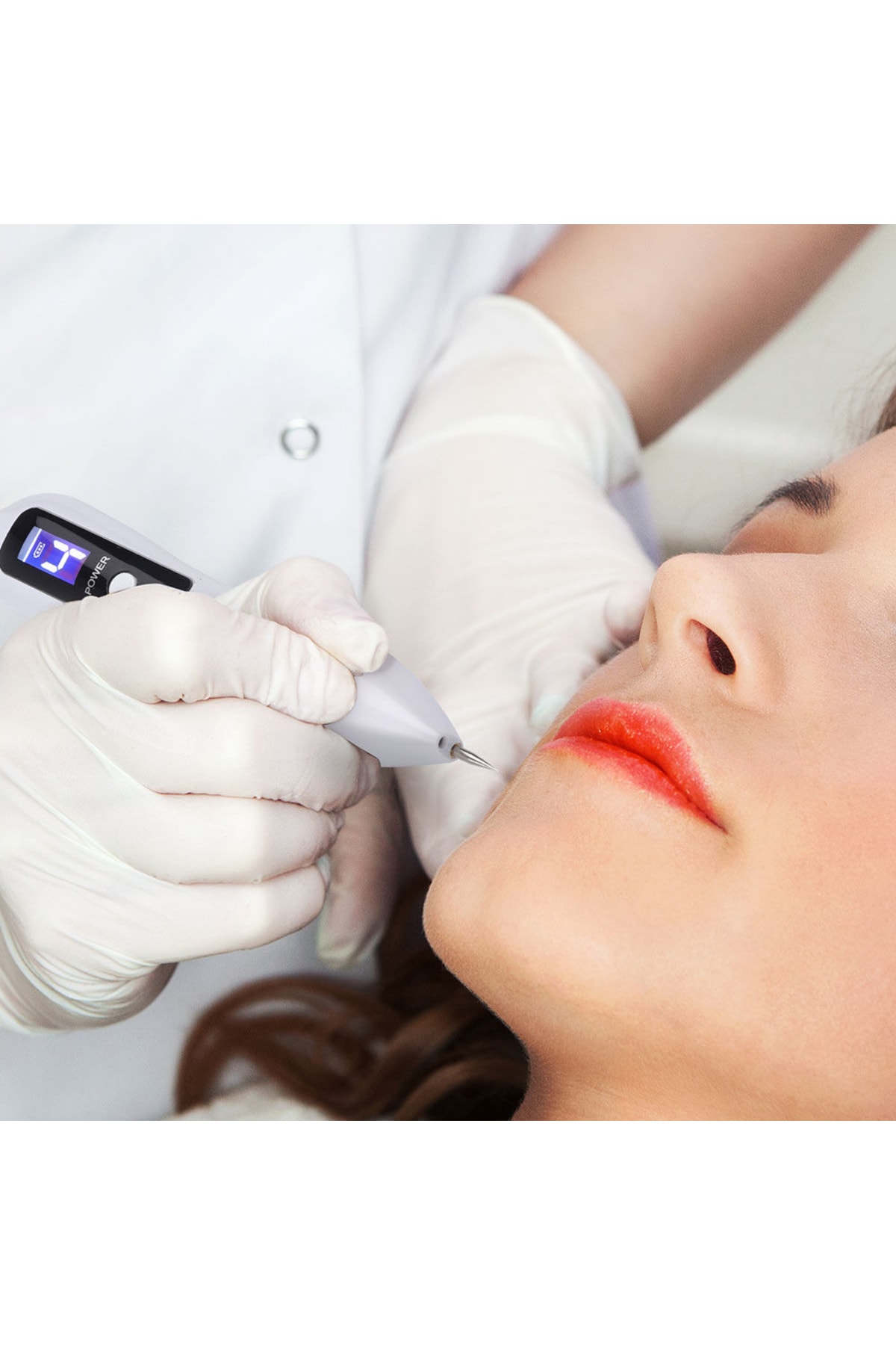 SYNOPE Profesyonel 9 Kademe Dijital Laser Plazma Plasma Pen Plexr Kalem ...