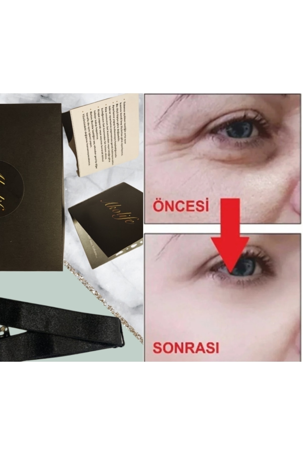 AKOLİFE Facelift Buckle -botox Clasp- Face Lift Tape (BLACK) - Yüz ...