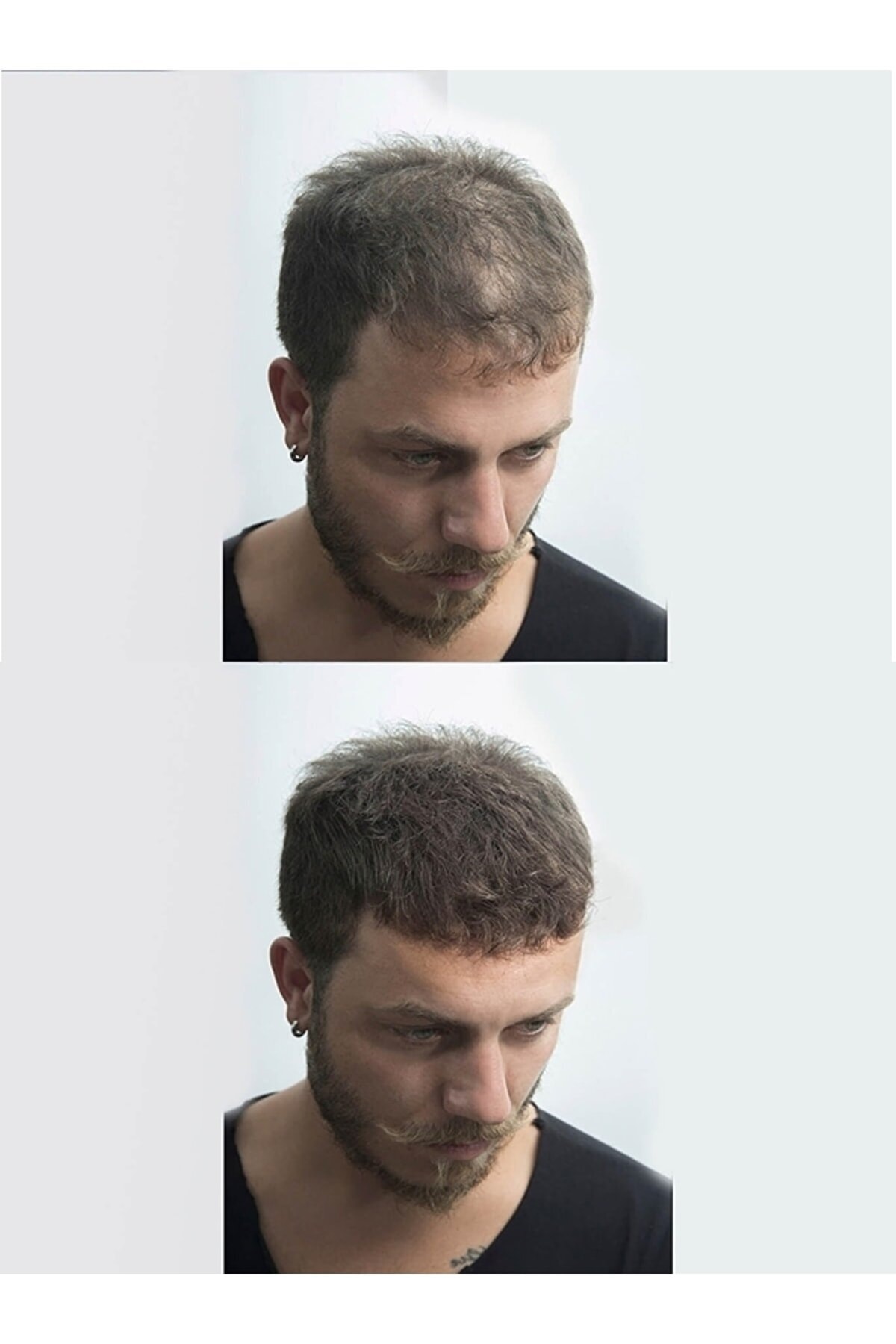 Jaja Orıjınal Yeni Ürün Fibers Saç Dolgunlaştırıcı Topik 50 Gr Saç Tozu ...