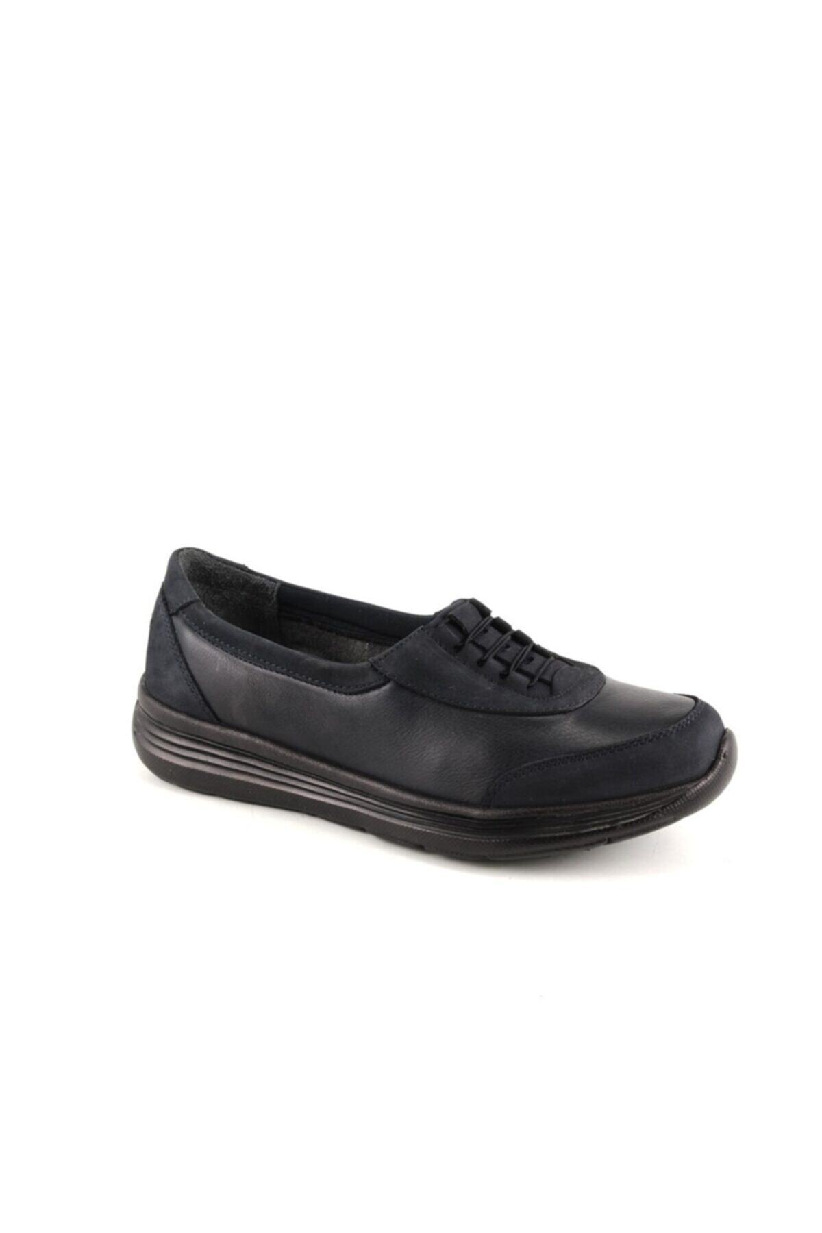 Forelli Kadın Deri Siyah Anatomik Ayakkabı 27609