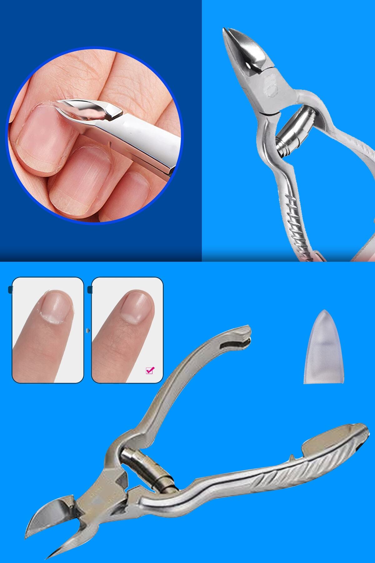 Xolo Podolojik Medikal Uygulama Pensi Çelik Inox Tırnak Et Pensi Pens ...