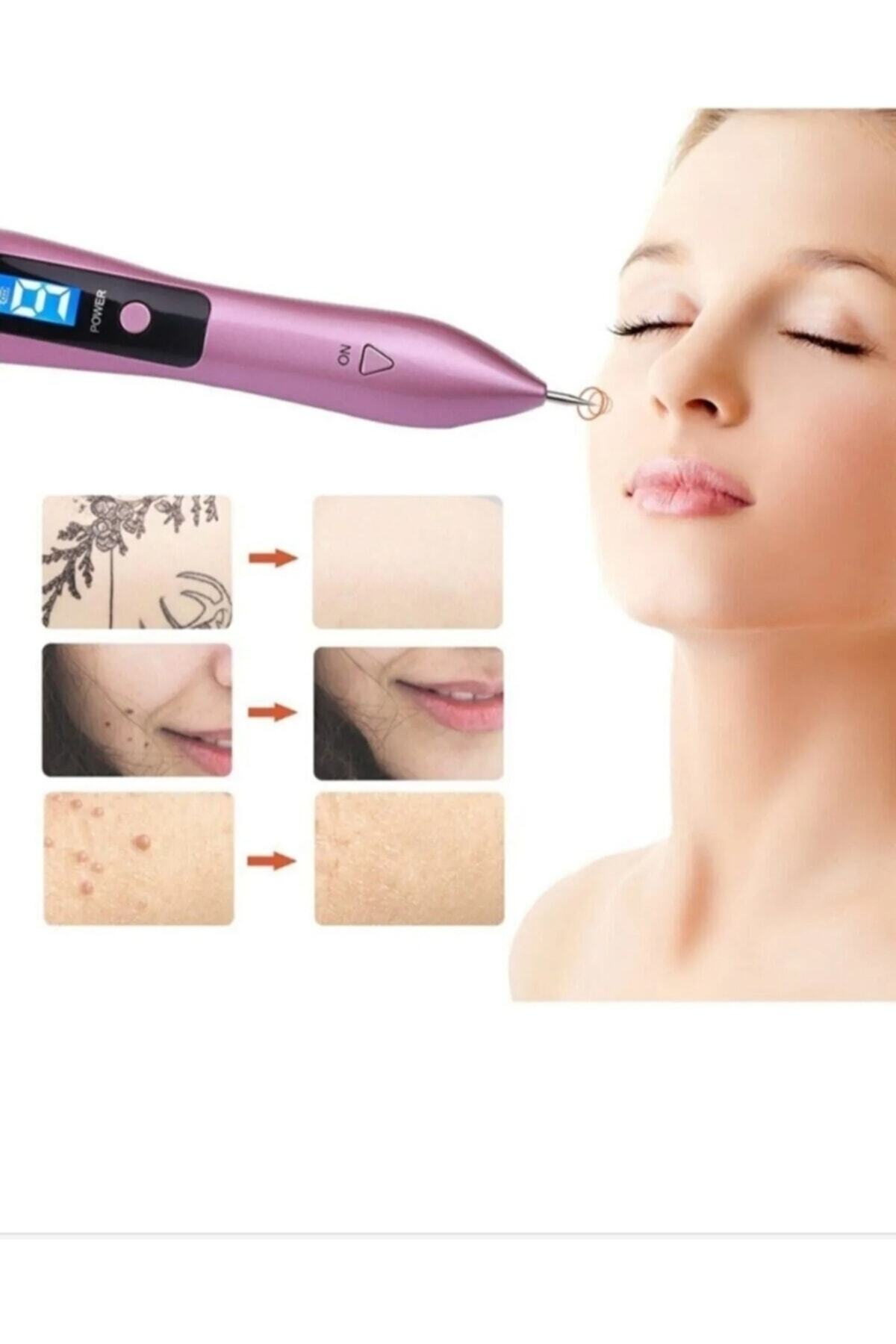 Plexr Plazma Pen 9 Kademeli Lazer Çok Fonksiyonlu Plasma Kalem Fiyatı ...