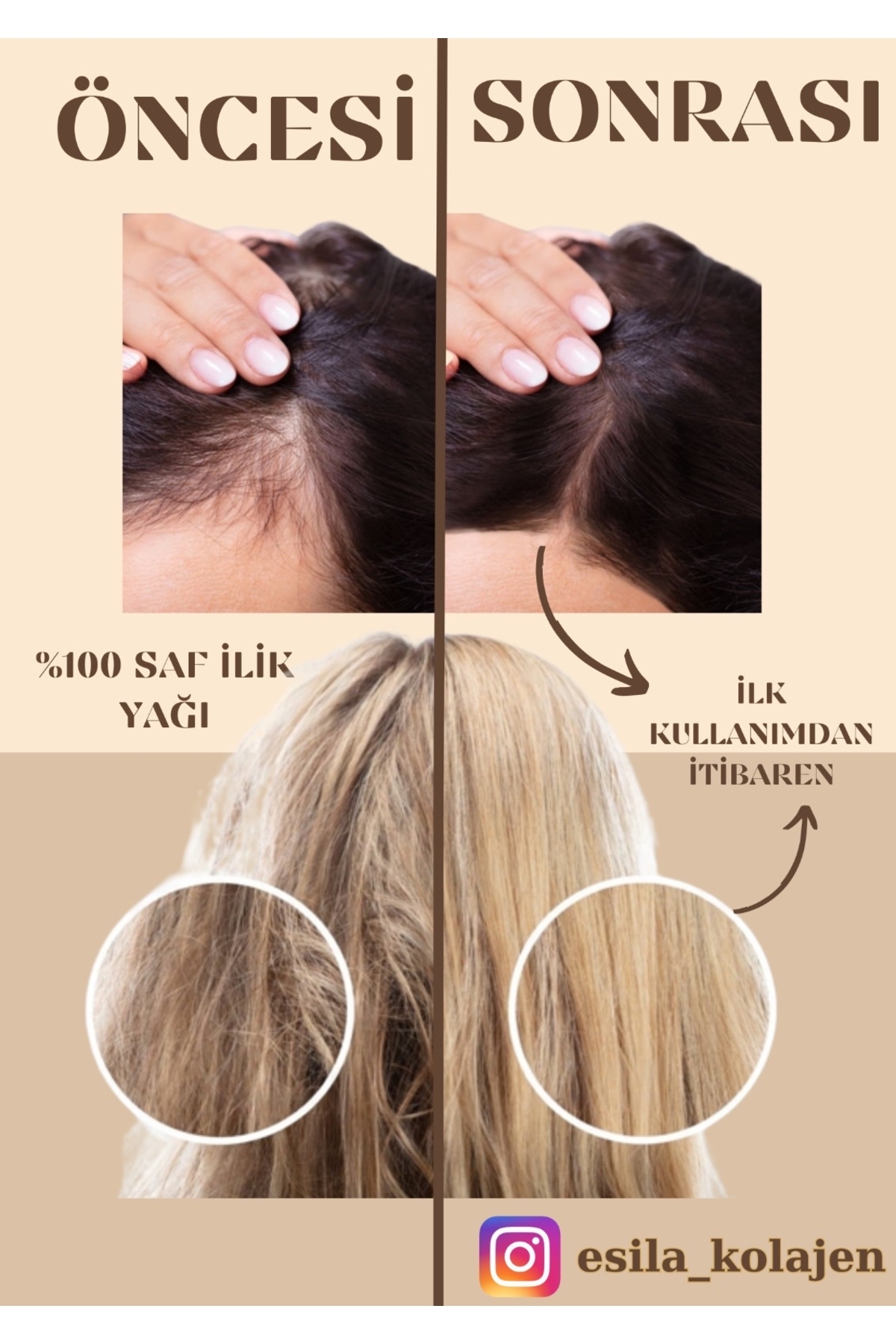 ESİLA KOLAJEN %100 Saf Ilik Yağı Bakımı - 1 Adet 40 Ml - Saç ...